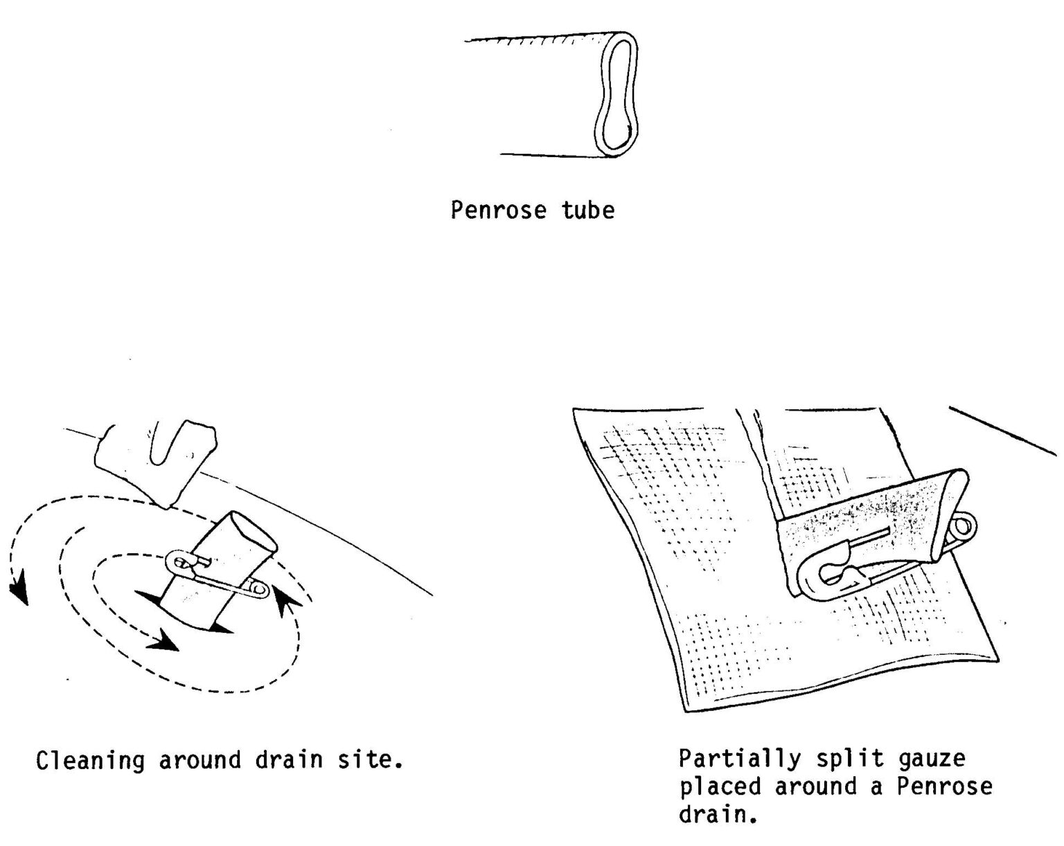 Lesson 4. Postoperative Care of the Surgical Patient - Nursing Care of ...