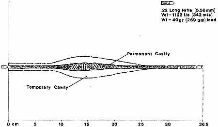 Emergency War Surgery: 22 Long Rifle wound tract