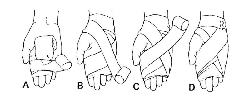 Lesson 6. Roller Bandages | fractures