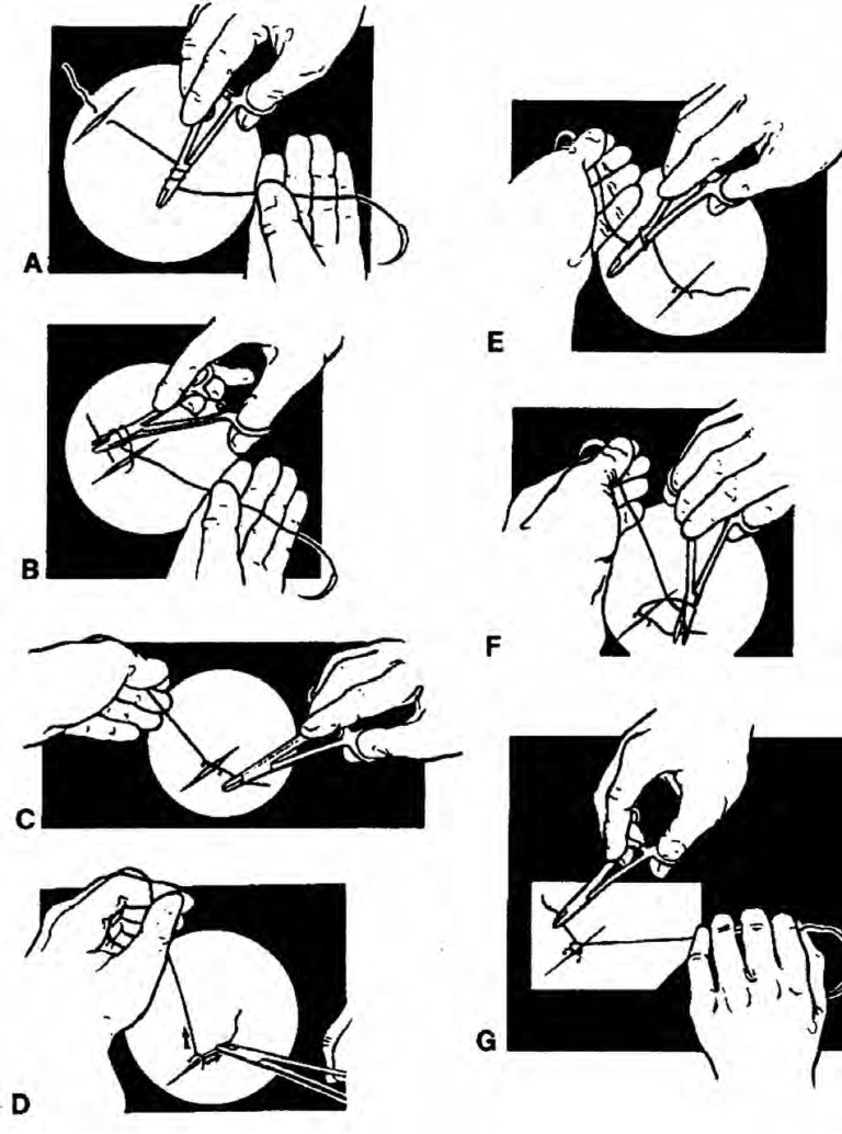 2-6. BASIC LACERATION REPAIR: C. Technique for the Simple Skin Suture ...